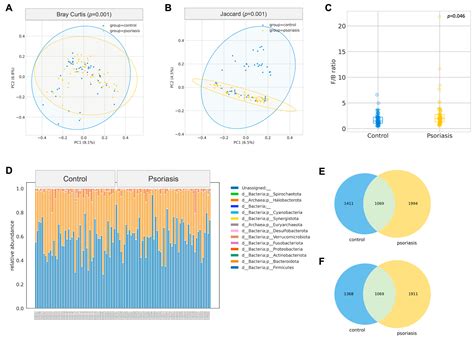 A Novel E3 Probiotics Formula Restored Gut Dysbiosis And Remodelled Gut