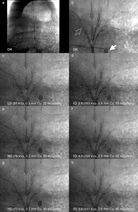 血管造影中的钽特异性对比噪声比或传统探测器剂量驱动的曝光控制：猪模型中的辐射剂量和图像质量评估 European Radiology Experimental X Mol