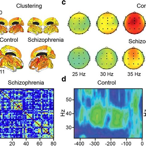 Disruption Of The Short Range Connectivity With Local Synchrony Deficit