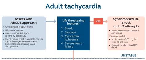 The Resus Council UK Adult Tachycardia Algorithm RCEMLearning