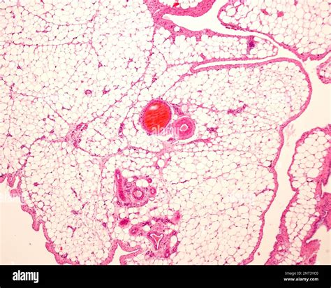 Very Low Magnification Light Microscope Micrograph Of White Adipose Tissue Or Fat Stained With