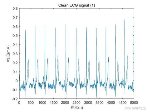 【心电信号ecg】基于matlab自适应lms、nlms和rls心电图噪声消除【含matlab源码 9959期】 自适应心电信号噪声消除算法