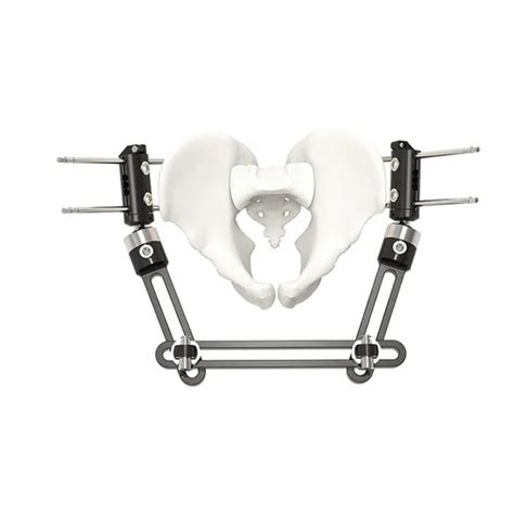 Fracture Surgery External Fixation Instrument Knee Joint Tibia Orthopedic External Fixator