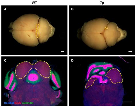 Inferior Colliculus Mouse