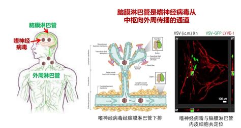 脑膜淋巴管从大脑中下排嗜神经病毒感染 复旦大学脑科学转化研究院