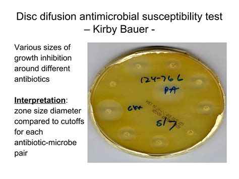 Antimicrobial Susceptibility Testing Basic Elements Ppt Infectious