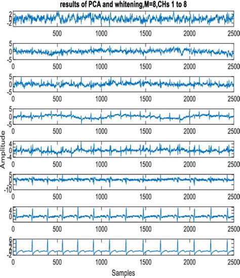 Figure 10 From Blind Source Separation Of Fetal Ecg Using Fast Independent Component Analysis