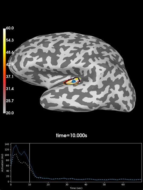 Compute Power Spectral Density Of Inverse Solution From Single Epochs — Mne 1101 Documentation