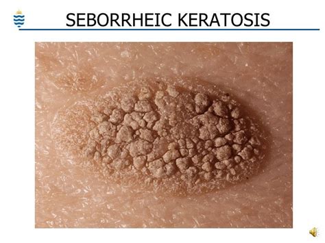 Pathology Of Skin Common Disorders