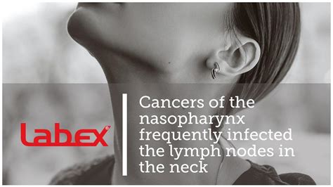 Cancers Of The Nasopharynx Frequently Infected The Lymph Nodes In The Neck By Laryngectomy