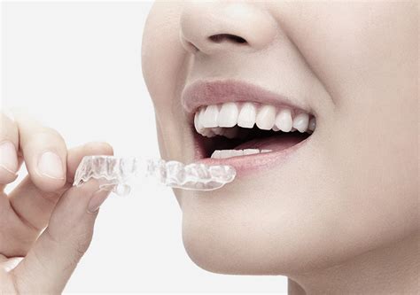 Clear Aligner Dental Treatment In Korea Gangnam Gentle Dental Clinic In South Korea