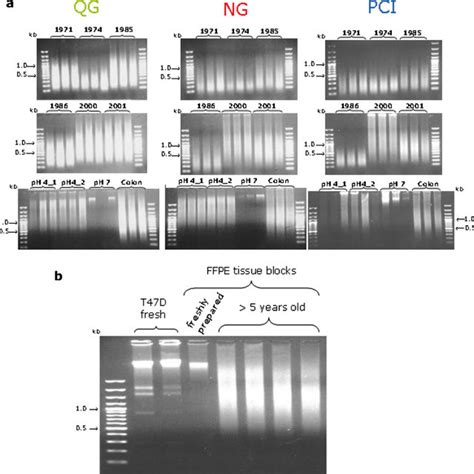 Maximum Amplifiable Pcr Products From Dna Extracted From Different Ffpe Download Scientific