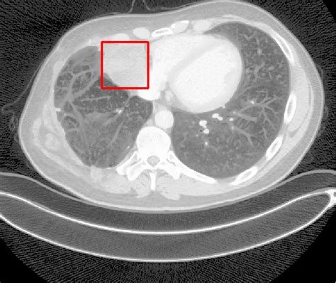 Lesion Detection Results The Red Bounding Boxes Represent Ground Truth Download Scientific