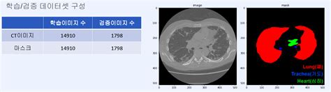 Cv Project Semantic Segmentation Aaa All About Ai