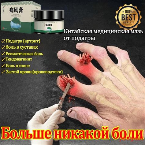 подагра мазь подагра лечение средство для лечения боли в суставах колена и мышцах при артрите