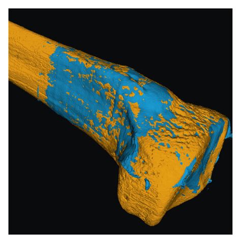 Results Of The Segmentation Process A One Slice Of The Ultrasound