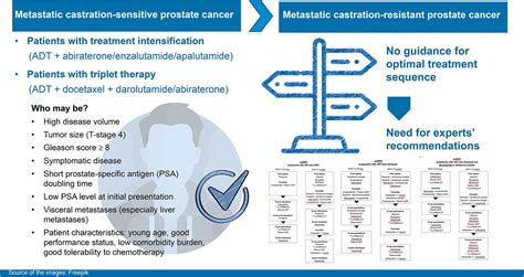 Expert Opinion On Current Treatment Alternatives For Patients With