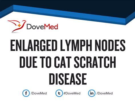 Enlarged Lymph Nodes Due To Cat Scratch Disease Dovemed
