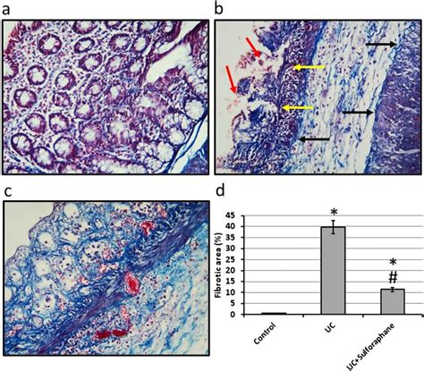Colon Sections Stained With Masson Trichrome In Control Group A