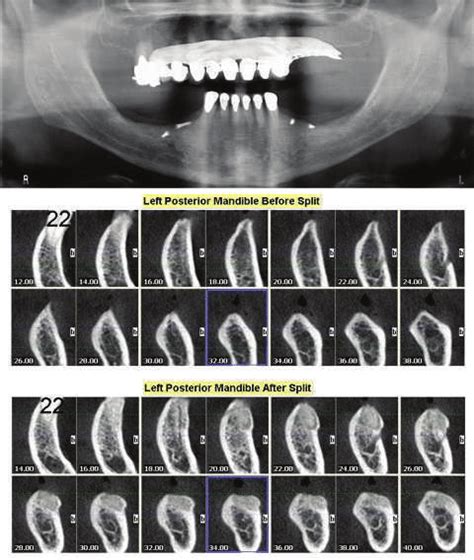 Cone Beam Computerized Tomography Cbct Slices Are Useful In Providing Download Scientific