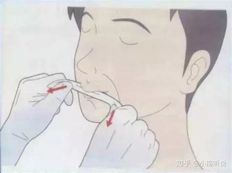 家长课堂唇运动障碍及其10种训练方法 知乎