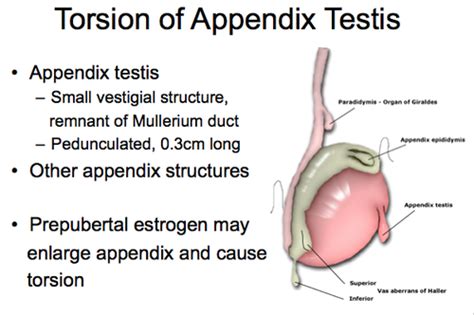 Torsion Of Appendix Testis