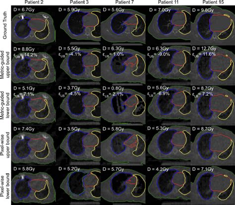 Figure 2 From Metric Guided Image Reconstruction Bounds Via Conformal Prediction Semantic Scholar