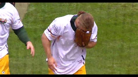 Packers Clay Matthews Hit In Face By Line Drive In Softball Charity