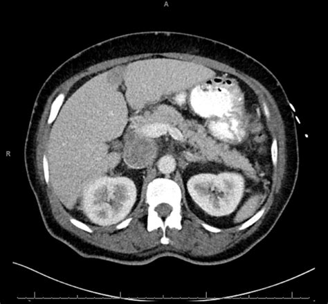 July 2024 Applied Radiology