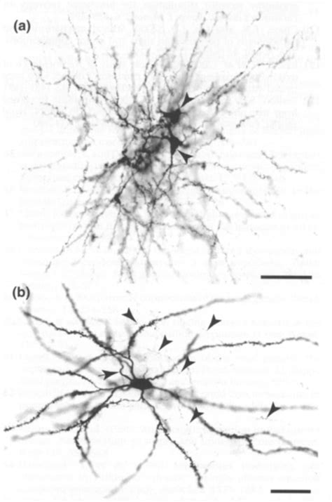 Biotin Dextran Amine Injections In Primate Striatum A Injection