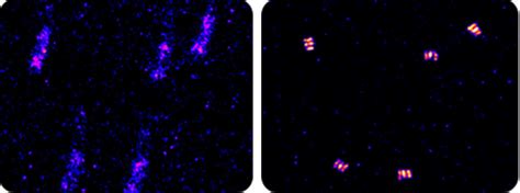 Aim Algorithm Enhances Super Resolution Microscope Images In Real Time Bioengineering Illinois