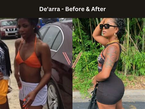 Celebrities With Bbl Before And After Photos
