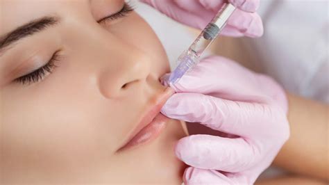 Cheiloplasty Guide Types Procedure And Recovery Explained