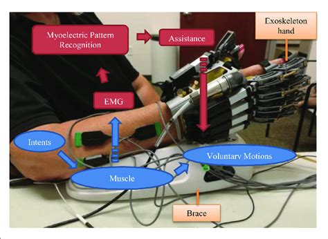 Training With The Exoskeleton Hand Driven By Myoelectric Pattern Download Scientific Diagram