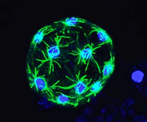Comparative Genomics Of Eukaryotic Microbes Genomes In Flux And Flux Between Genomes