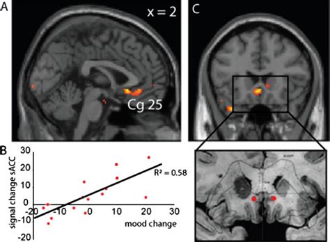 Subgenual Cingulate Subgenual Anterior Cingulate Cortex [sacc] Cg25 Download Scientific