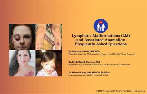 Lymphatic Malformation Lymphangiomas Vascular Birthmarks Foundation