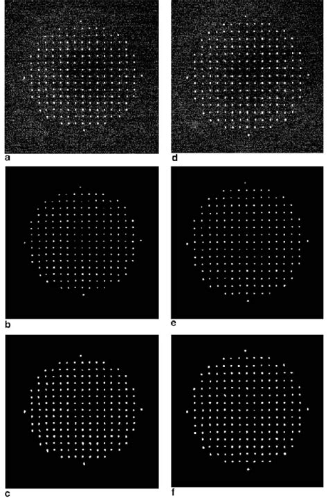 A Hartmann Pattern Yielded By A Toroidal Convex Surface Test
