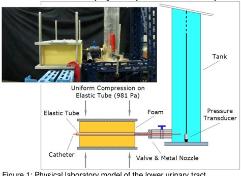 Figure 1 From Urodynamic Assessment Impact Of Urethral Catheter