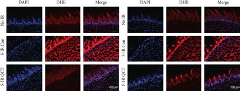 Quercetin Attenuates Ir Induced Ros Generation A Mouse Tongues Were Download Scientific