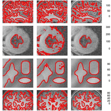 Comparisons With Local Active Contour Model Using A Synthetic Image And Download Scientific