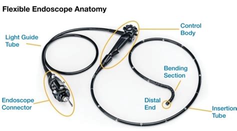Broken Endoscopes