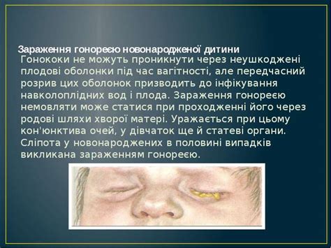 гонорея презентація з медицини