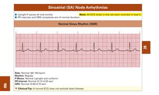 0803613474 Ecg Notes Interpretation And Management Guidepdf