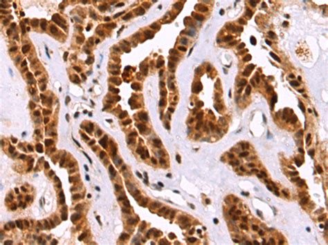 兔抗runx1多克隆抗体anti Runx1 Rabbit Polyclonal Antibody 生命科学产品与技术服务 生工生物工程