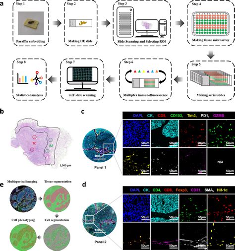 Identification And Characterization Of Tumor Microenvironment In Download Scientific Diagram