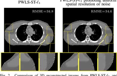 Figure 2 From Sparse View X Ray Ct Reconstruction Using Cid96 1 Regularization With Learned