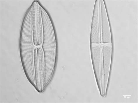 A Diatom Sample Image Captured In Brightfield Microscopy B Download Scientific Diagram