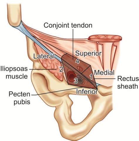 Pecten Pubis Conjoint Tendon