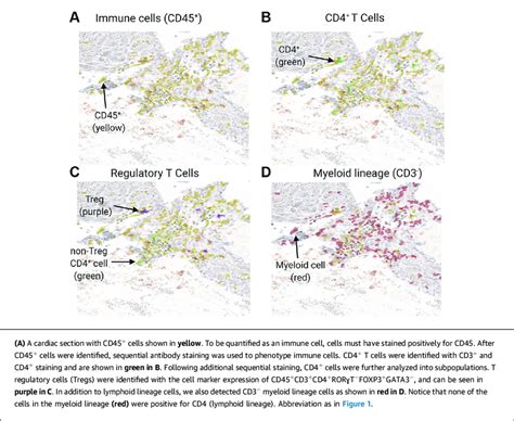 Representative Mihc Staining Used For Immune Cell Quantification Download Scientific Diagram